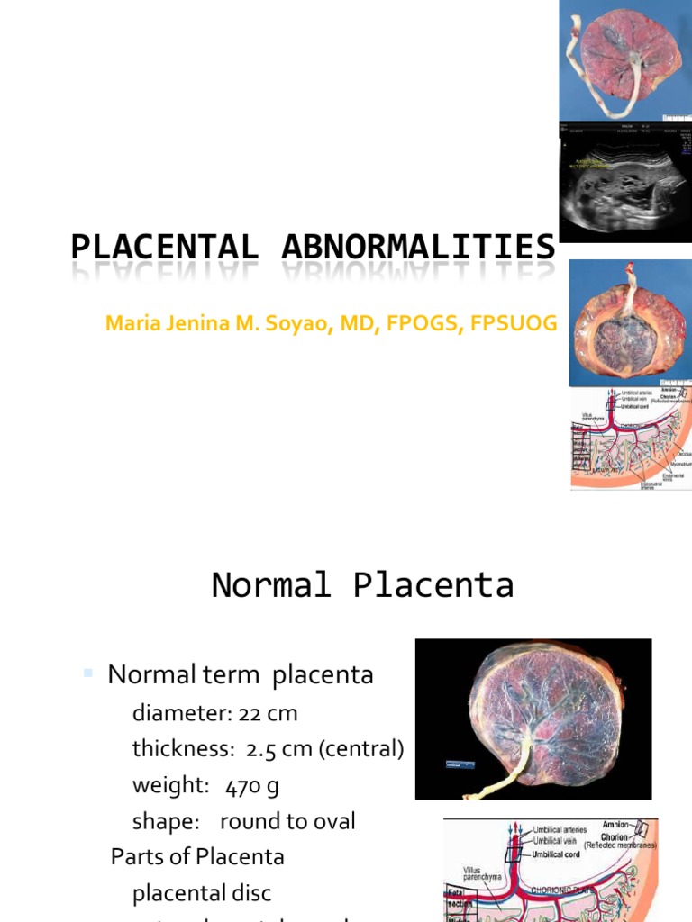 Placental Abnormalities | PDF | Placenta | Fetus