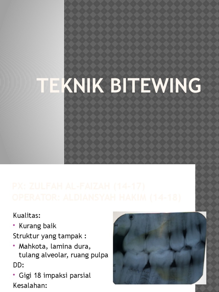 Teknik Bitewing Radiologi | PDF