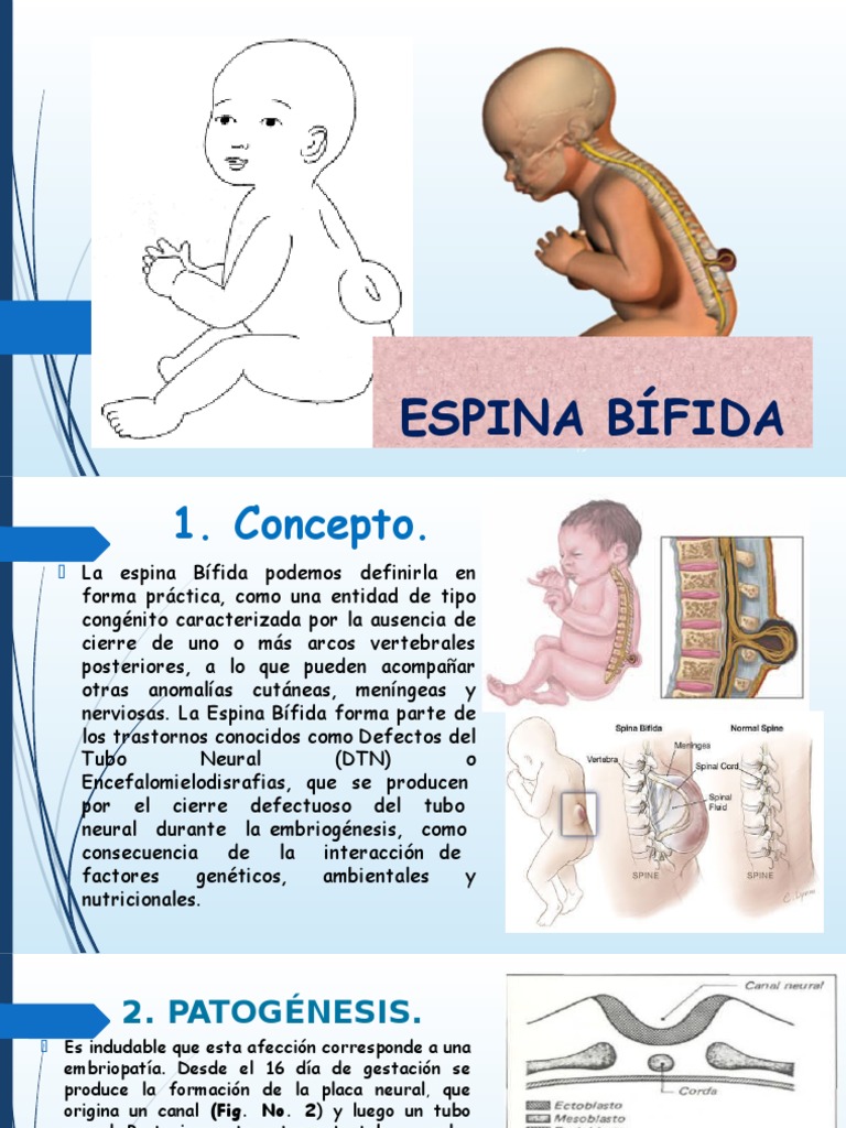 Espina Bífida | PDF | Especialidades Medicas | Medicina CLINICA