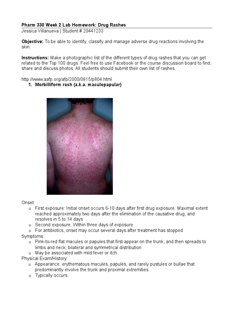 Types of Drug Rashes | PDF | Dermatology | Clinical Medicine