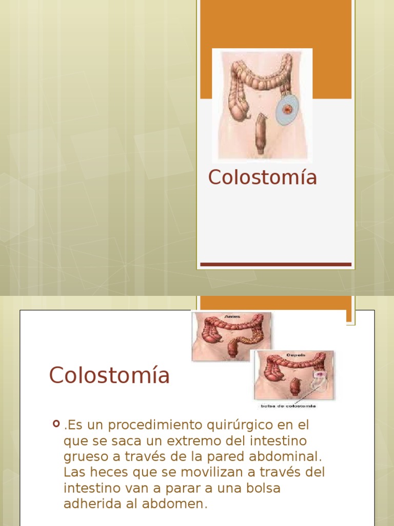 Procedimiento de Colostomía | PDF | Heces | Cirugía