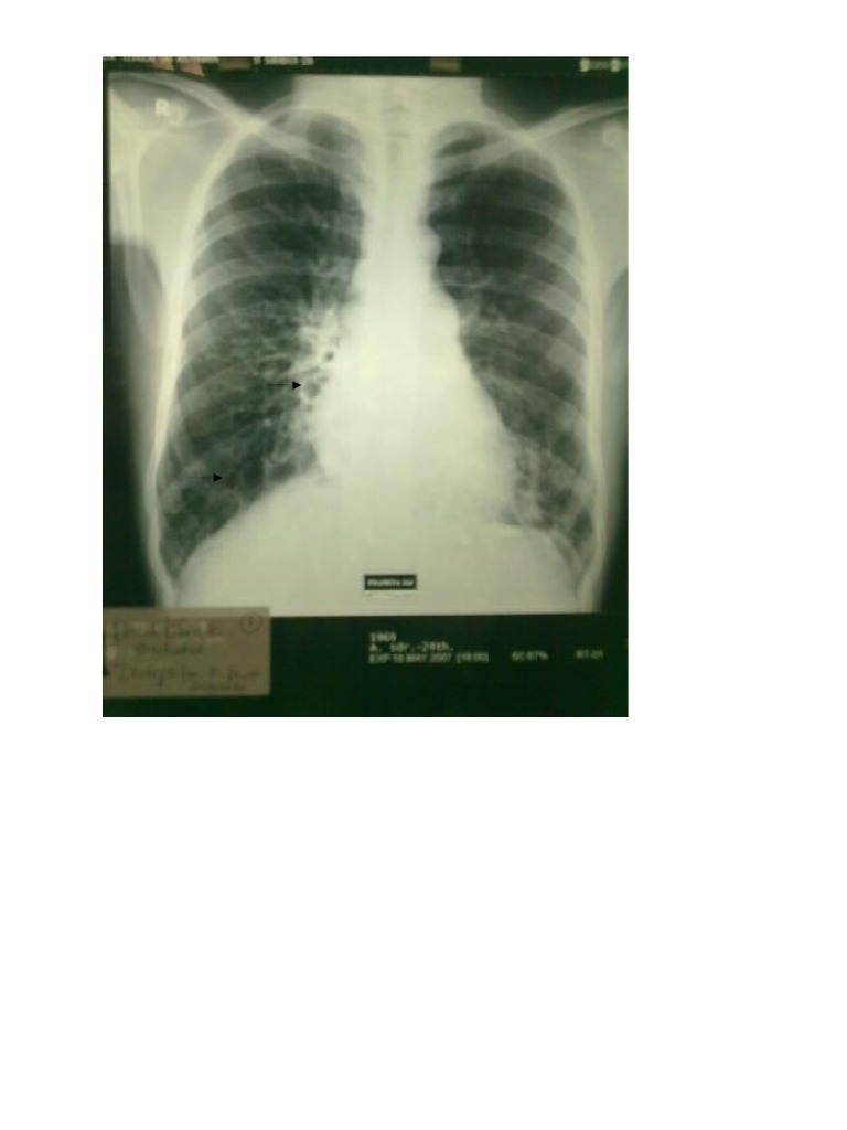 Radiologi Cara Baca | PDF