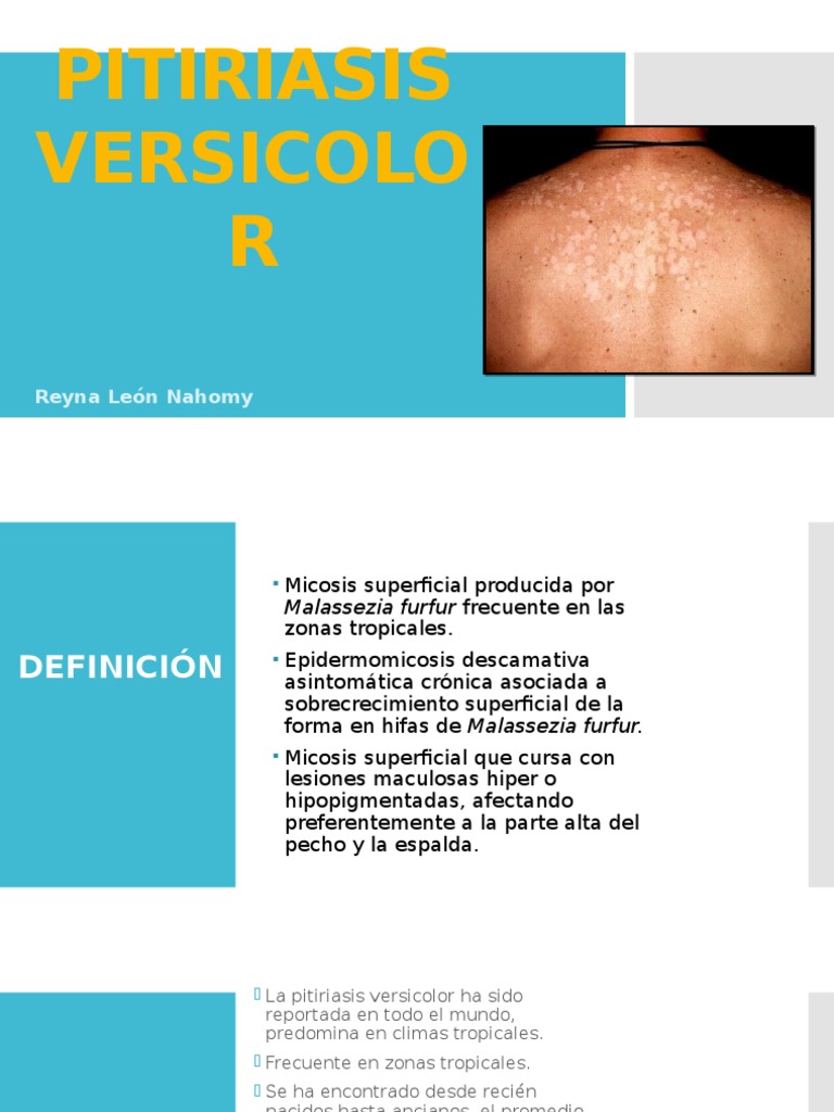 Pitiriasis Versicolor | PDF | Medicina | Medicina CLINICA