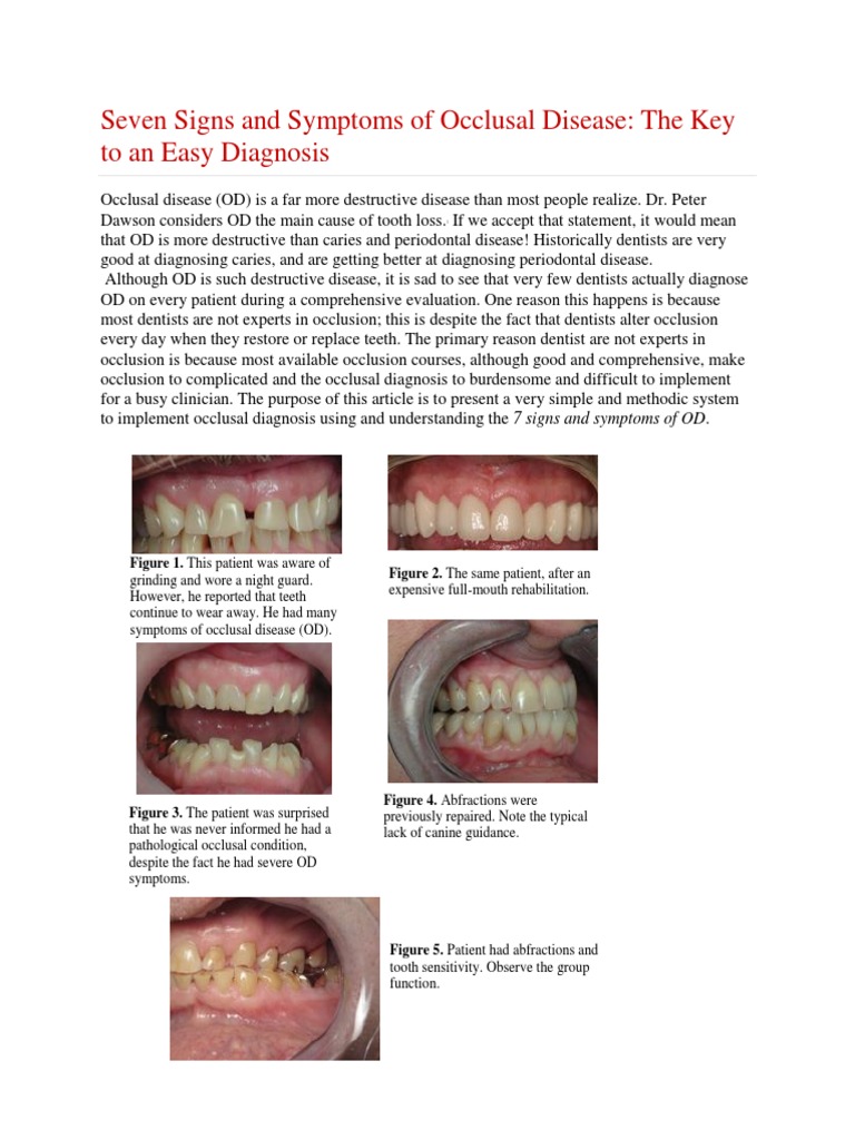 MC - Seven Signs and Symptoms of Occlusal Disease | Medical Diagnosis ...