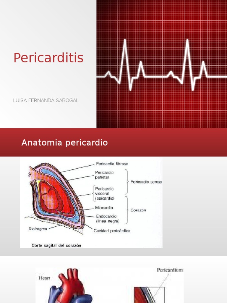 Pericarditis Presentacion | Medicina CLINICA | Especialidades Medicas