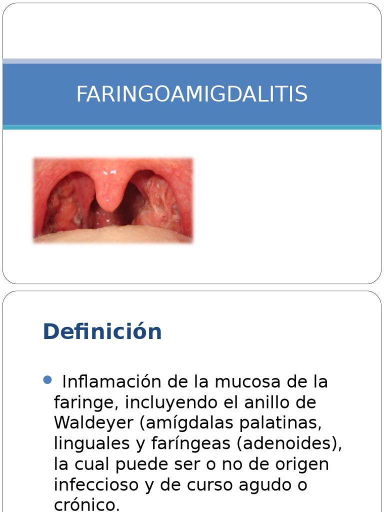 Faringoamigdalitis | PDF | Penicilina | Inmunología