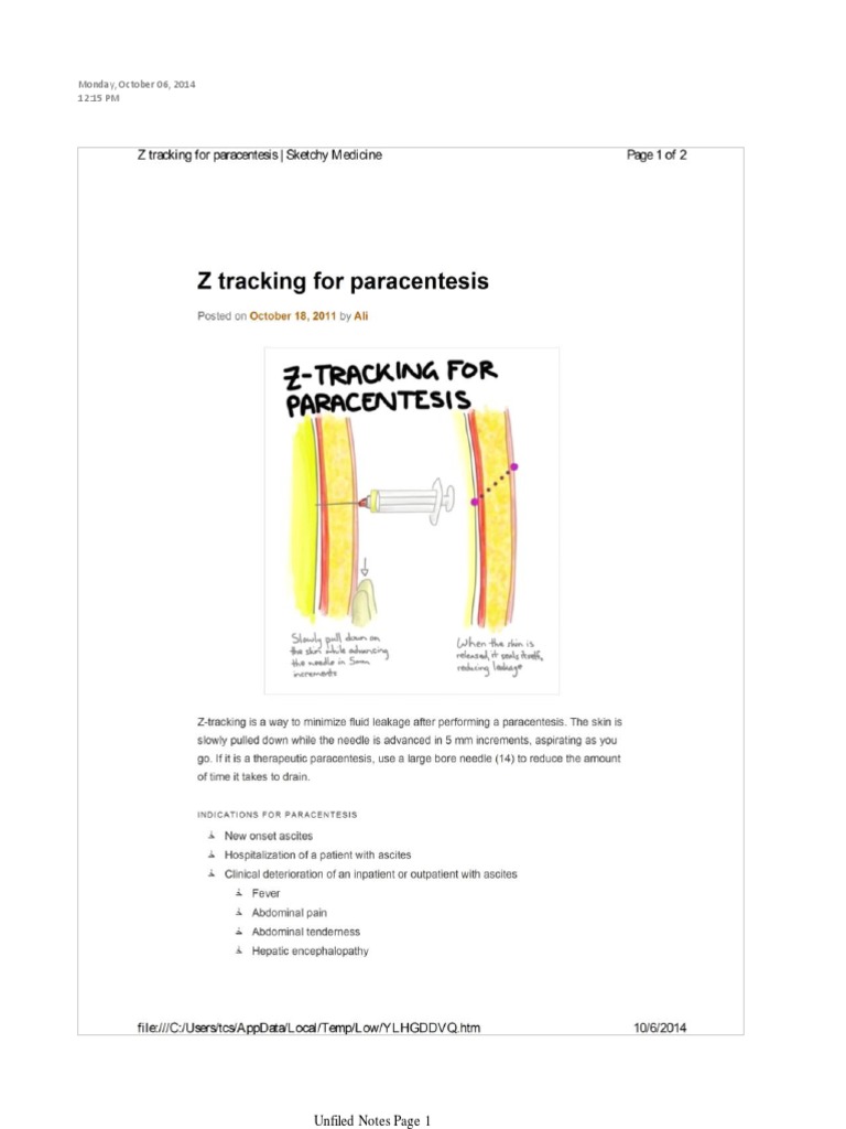 Z Tracking Paracentesis | PDF