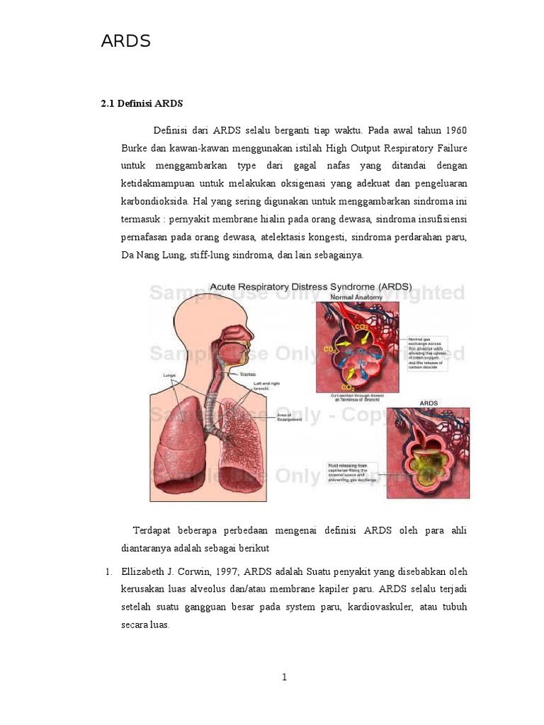 Ards | PDF