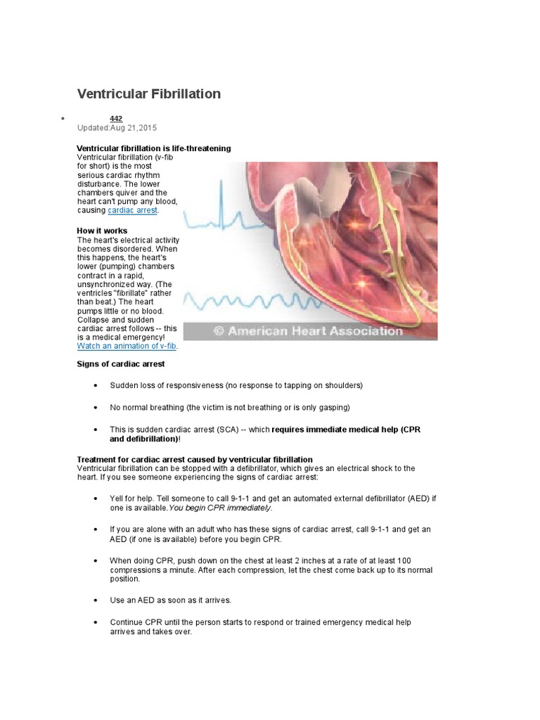 Ventricular Fibrillation | PDF | Cardiac Arrest | Heart