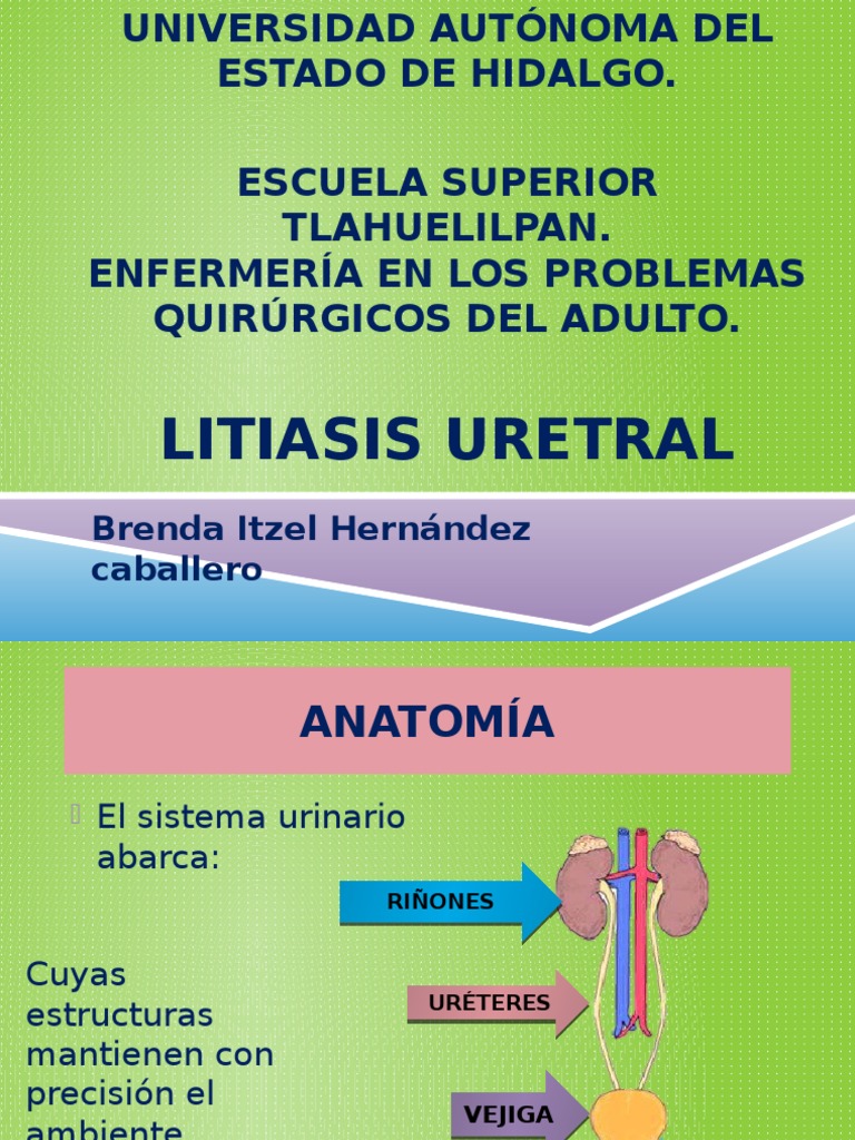 Litiasis Uretral | PDF | Riñón | Sistema urinario