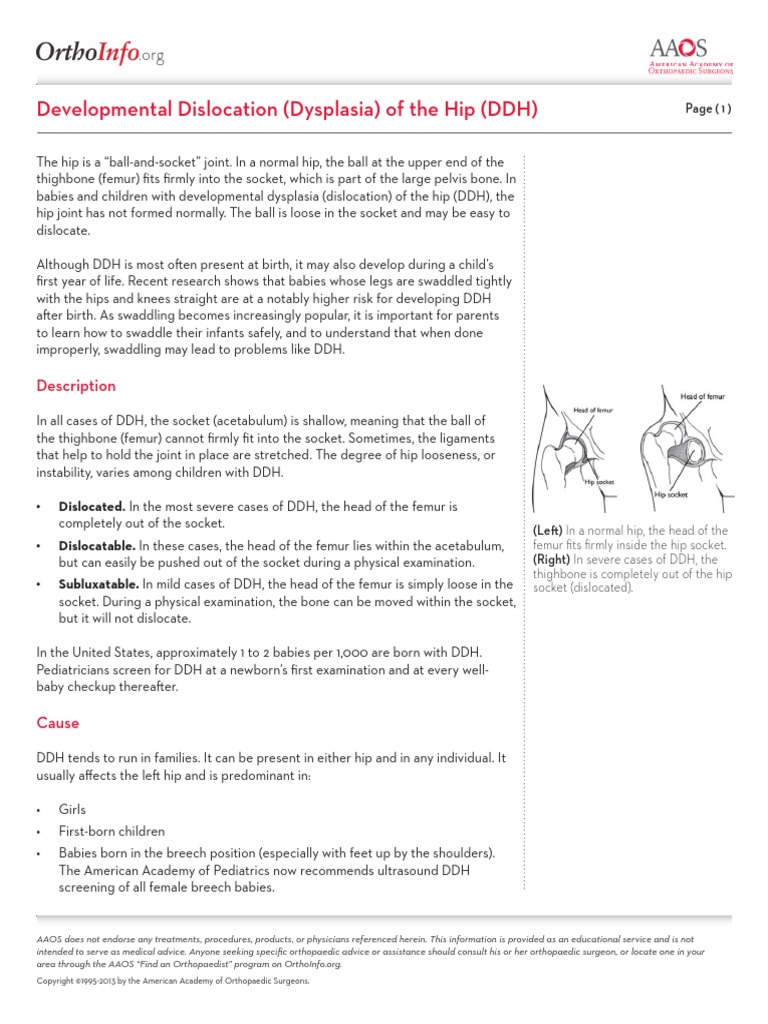 Developmental Dislocation (Dysplasia) of The Hip (DDH) : Description ...