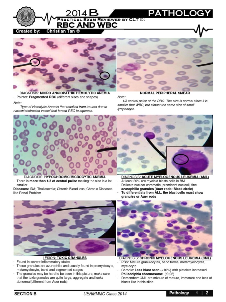 PATHO Practicals - RBC and WBC Pathology (CLT) | PDF | White Blood Cell | Anemia