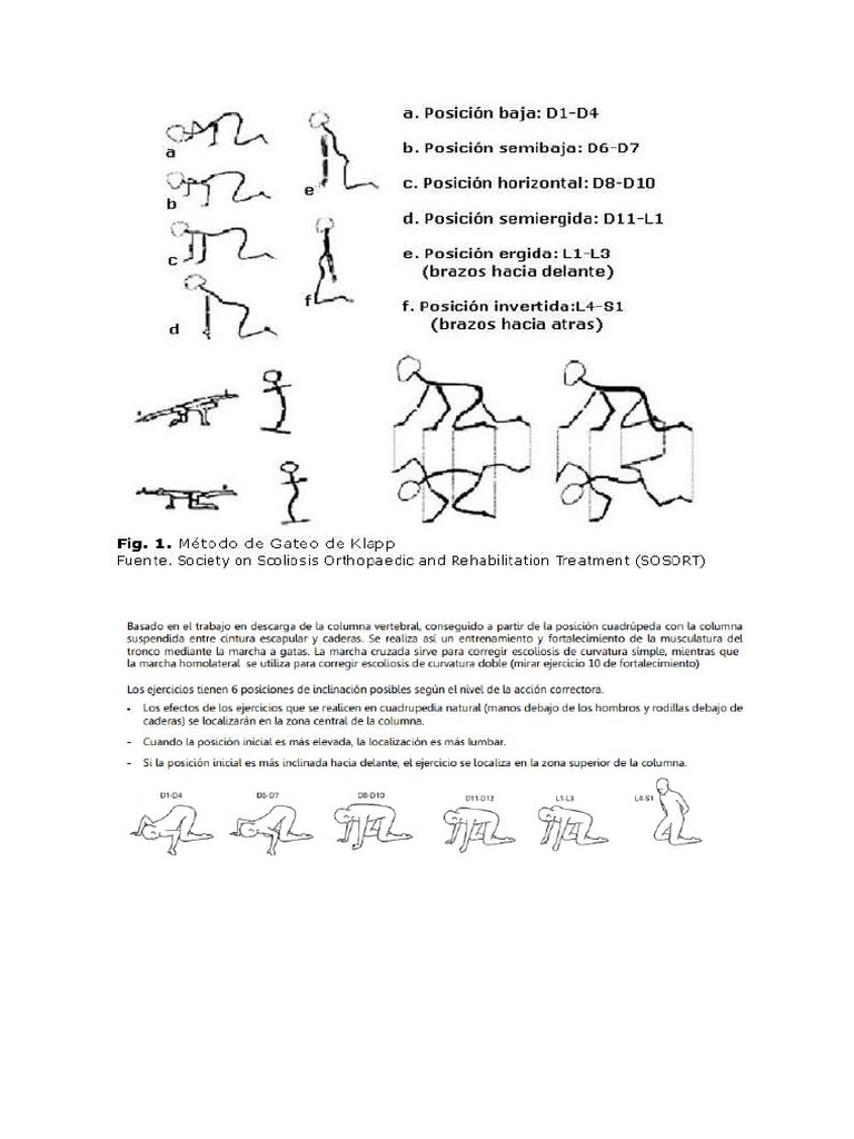Klapp Method | Scoliosis | Orthopedic Surgery
