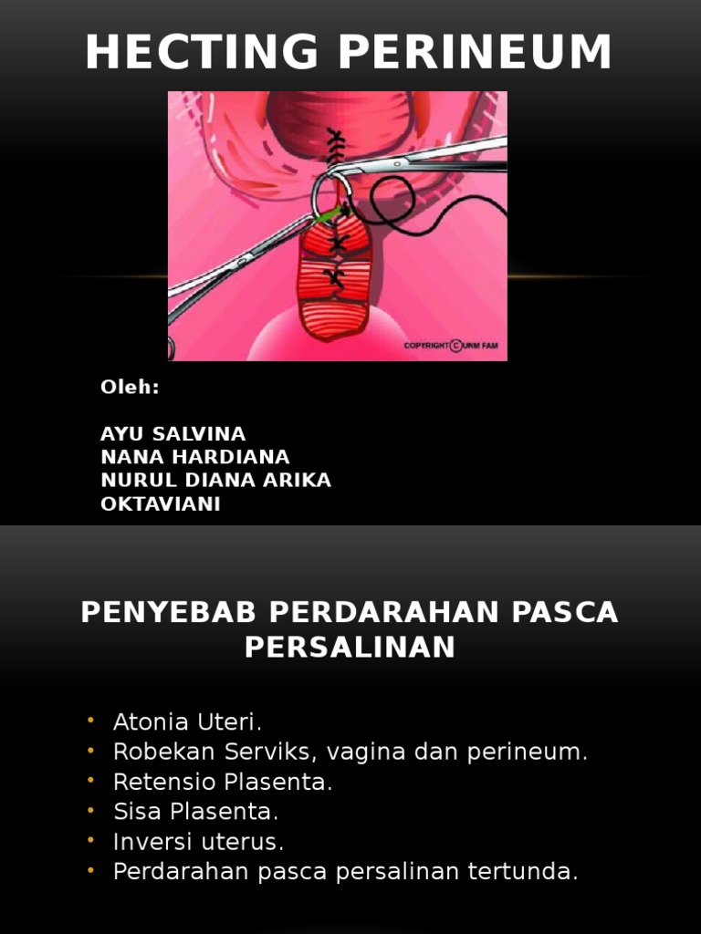 Hecting Perineum | PDF | Kesehatan Holistik