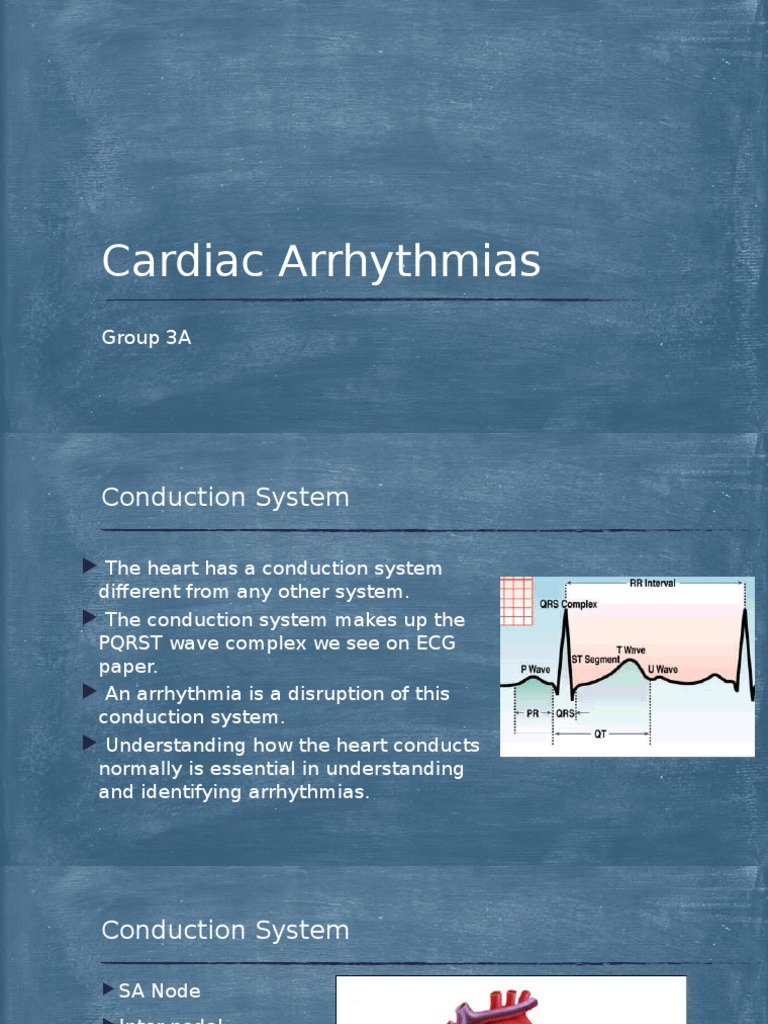 Cardiac Arrhythmias | PDF | Electrophysiology | Cardiovascular Physiology