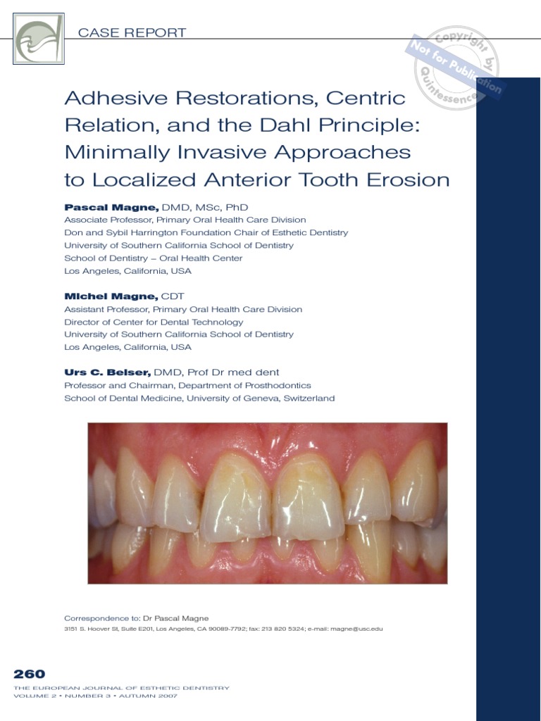 Adhesive Restorations in Centric Relation | PDF | Tooth Enamel | Dental ...