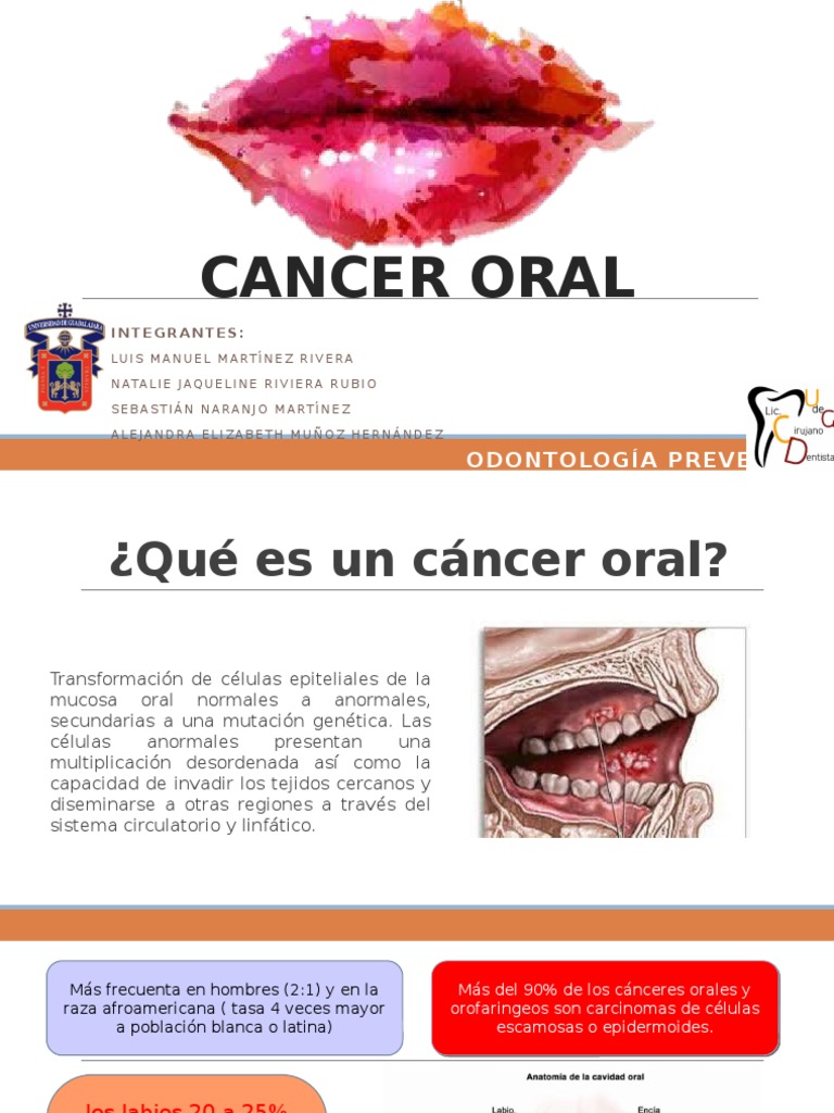 Cancer Labial | PDF | Cáncer | Ciencias de la Salud