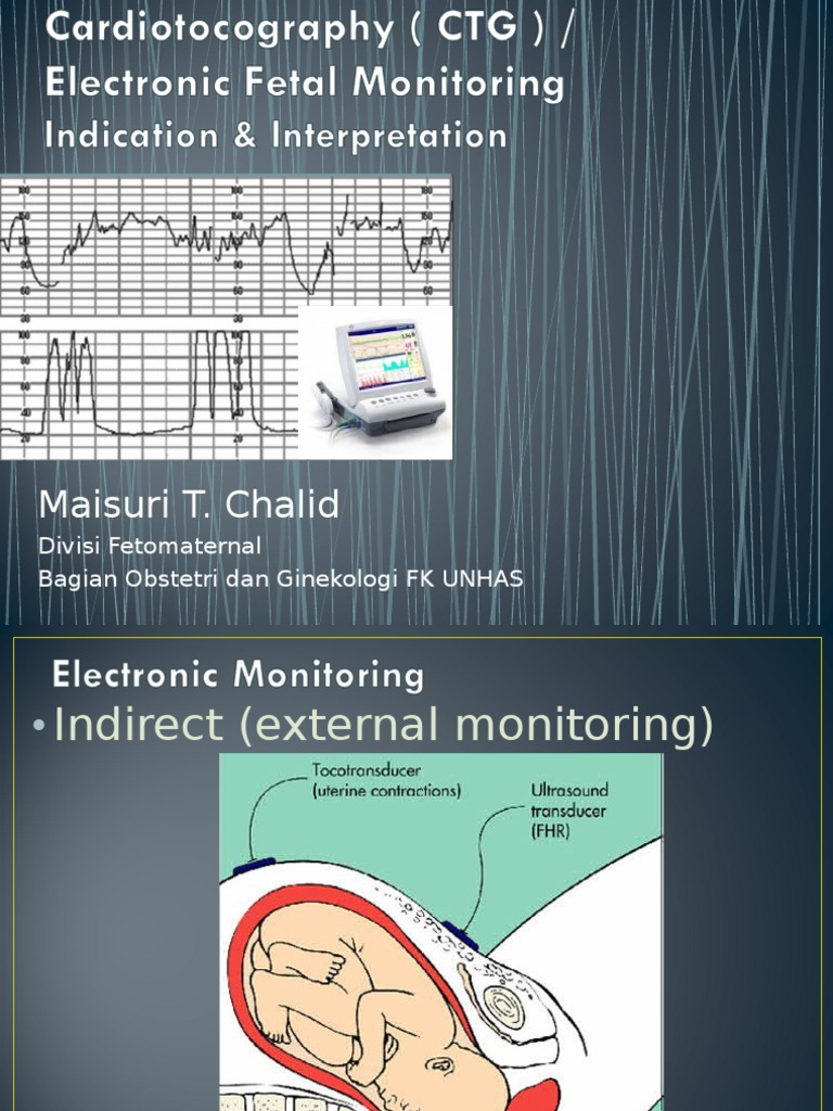 CTG Monitoring in High-Risk Pregnancy | PDF | Self-Improvement | Wellness