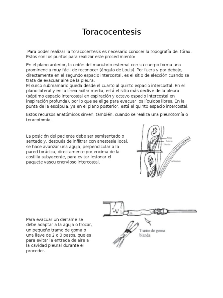 Toracocentesis | PDF | Especialidades Medicas | Medicina CLINICA