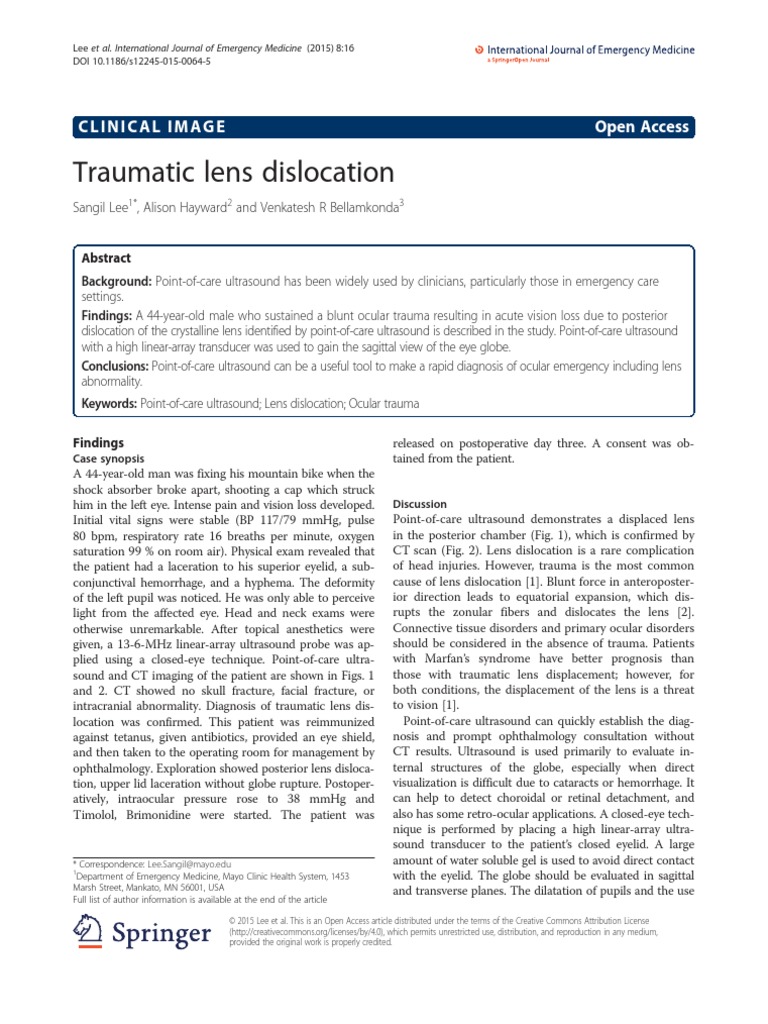 Traumatic Lens Dislocation: Clinicalimage Open Access | PDF | Major ...