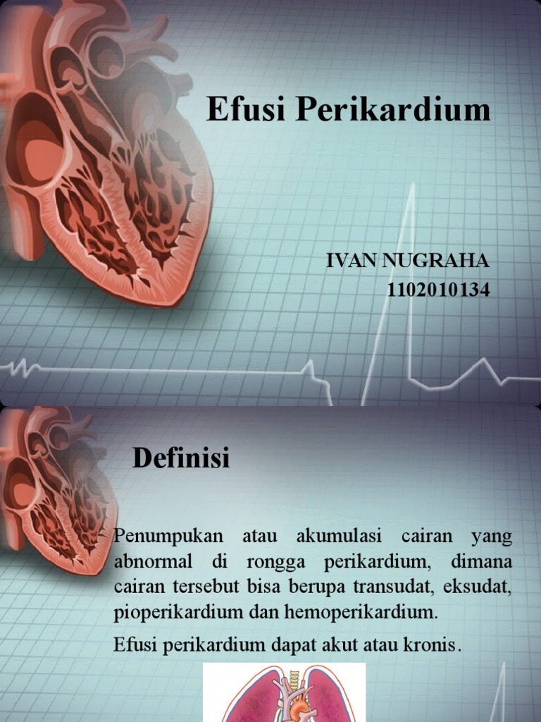 Efusi Perikardium | PDF