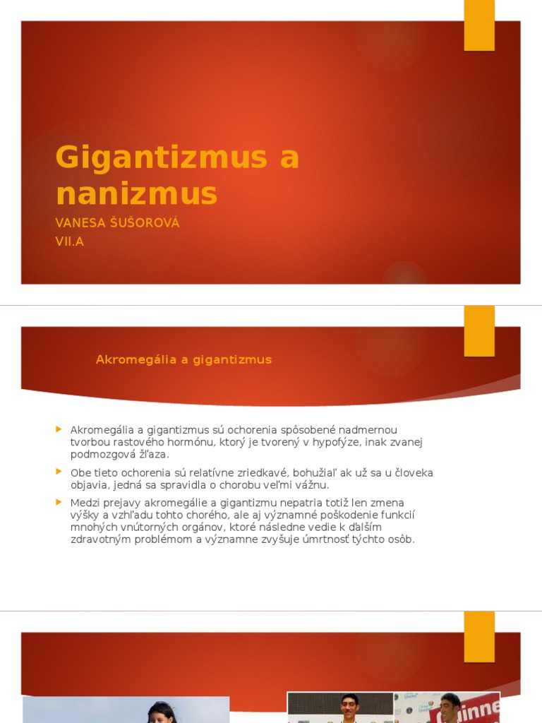 Gigantizmus A Nanizmus | PDF
