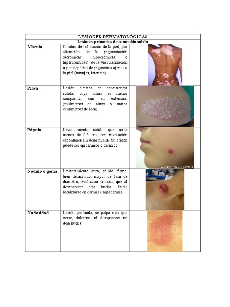 Lesiones cutáneas