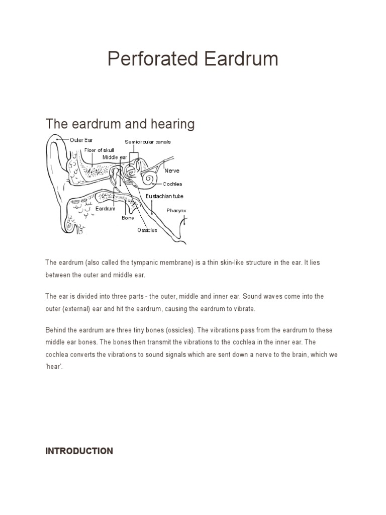 Perforated Eardrum | PDF | Ear | Hearing