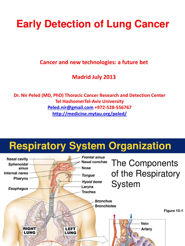 Early Detection Of Lung Cance Lung Cancer Carcinoma