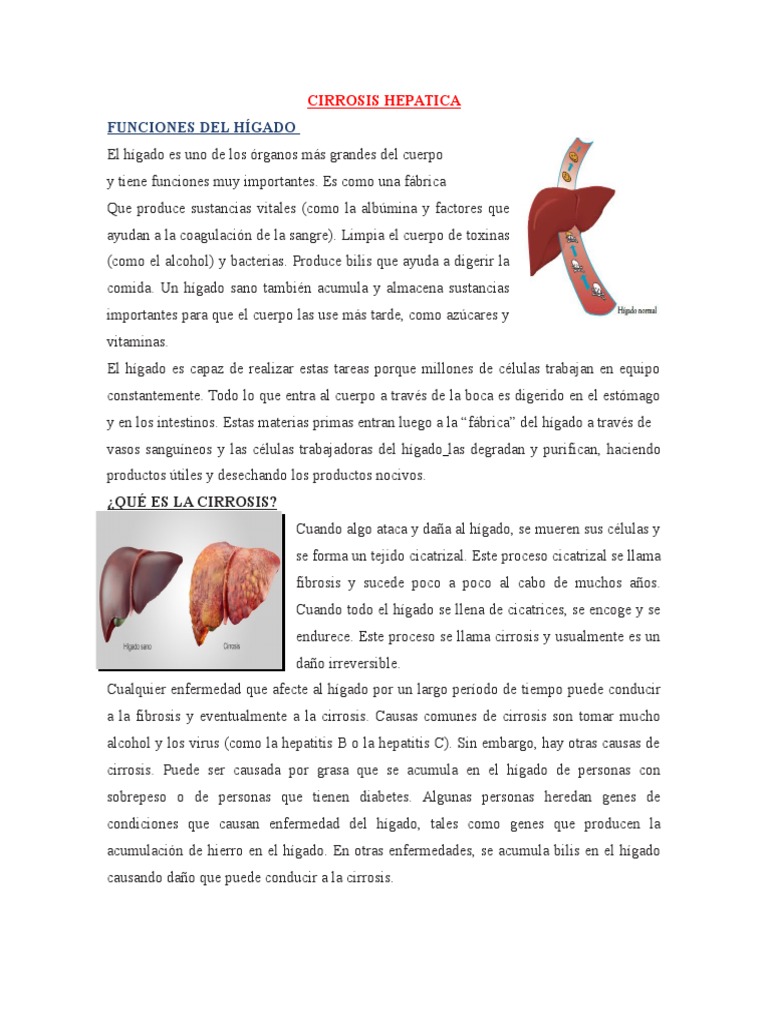 Fisiopatologia de La Cirrosis Hepatica | PDF | Cirrosis | Hepatitis