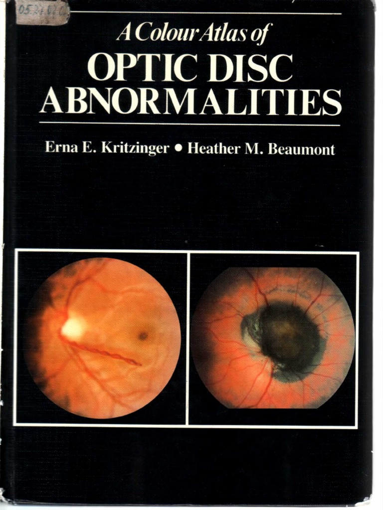 A Colour Atlas of Optic Disc Abnormalities - Kritzinger, Beaumont ...