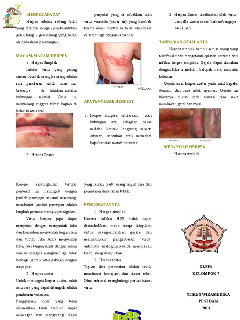 Leaflet Herpes | PDF
