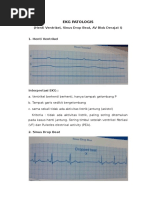 Gambaran EKG Normal Dan Stemi | PDF