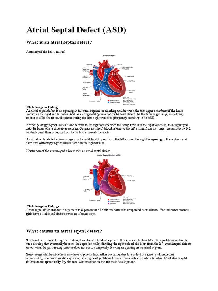 Atrial Septal Defect | Congenital Heart Defect | Heart