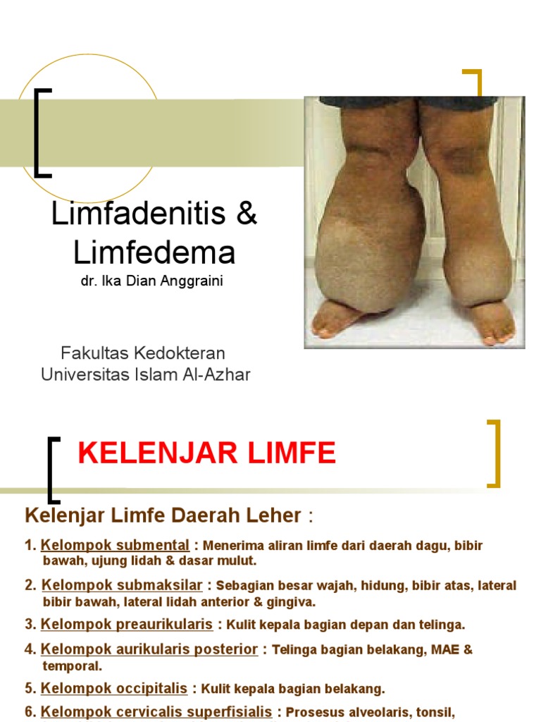 13 LIMFADEMA DAN LIMFADENITIS DR - Dian A | PDF