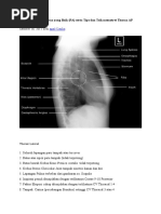 Thorax PA, AP Dan Lateral, RLD Dan LLD | PDF