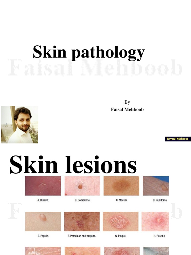 3.skin Pathology | PDF | Cutaneous Conditions | Dermatitis