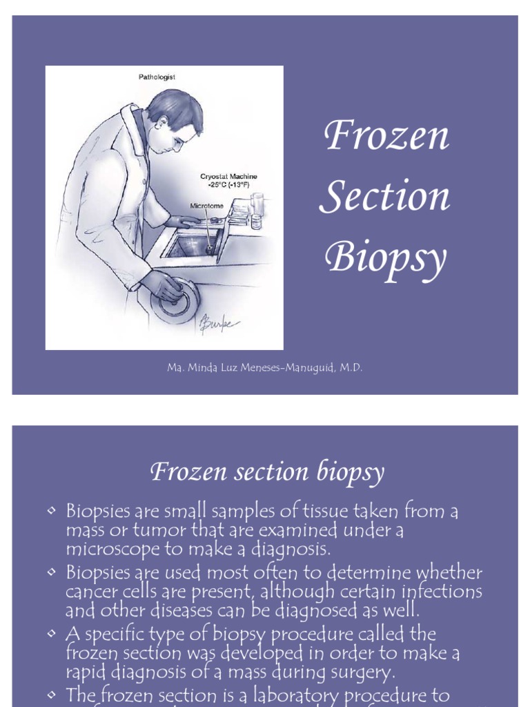 His to Tech Frozen | Biopsy | Pathology