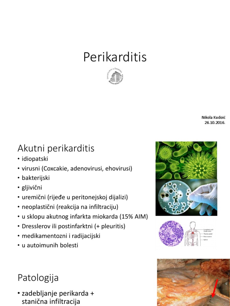 Perikarditis | PDF