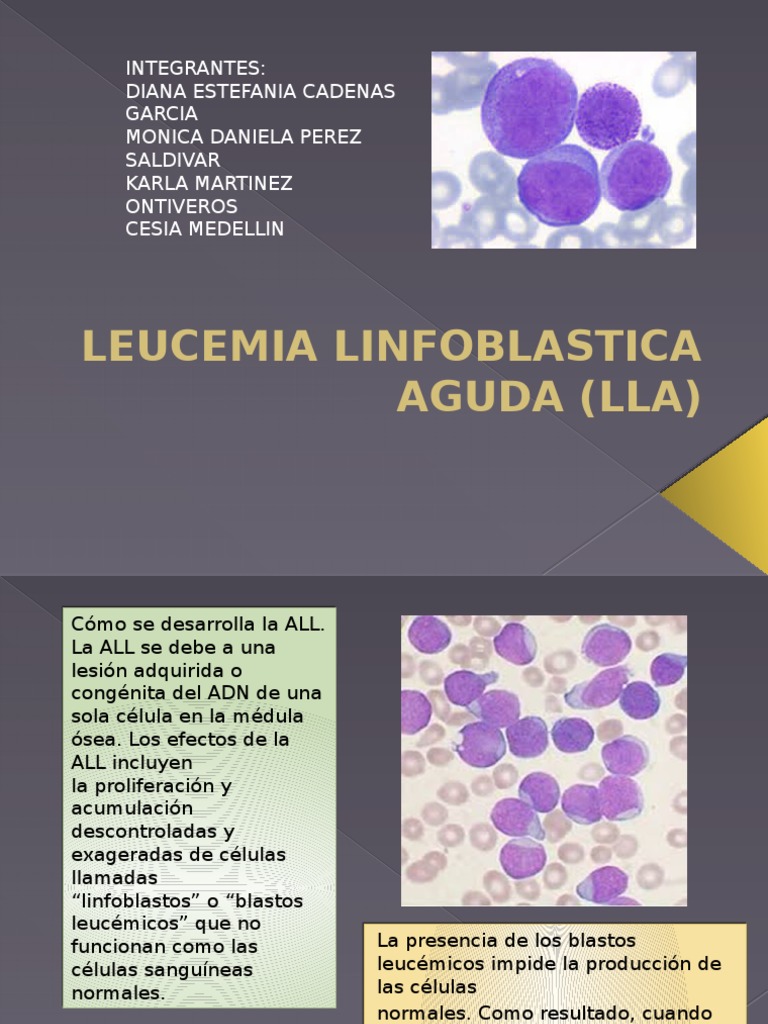 Leucemia LinfoBLASTICA Aguda (LLA) | Leucemia | Linfocitos