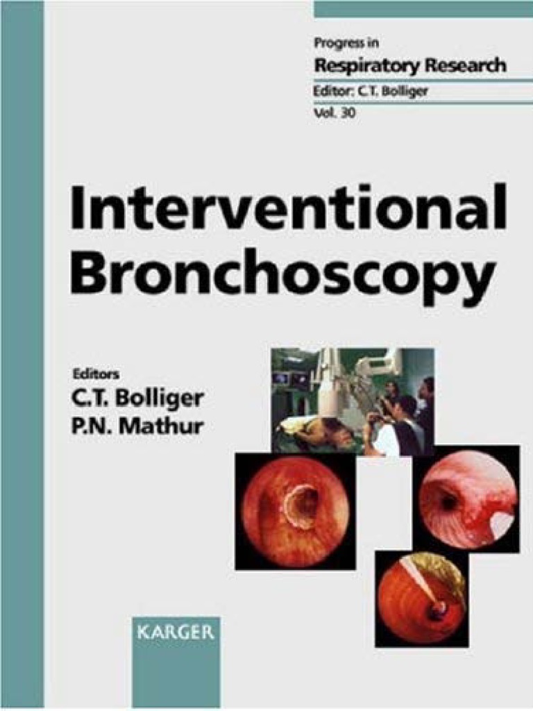 Interventional Bronchoscopy | Endoscopy | Lung Cancer