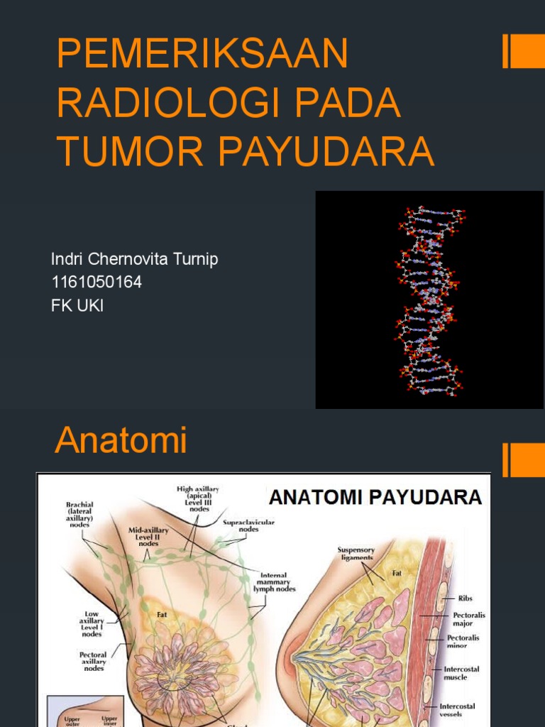 Referat Pemeriksaan Radiologi Pada Tumor Payudara | PDF