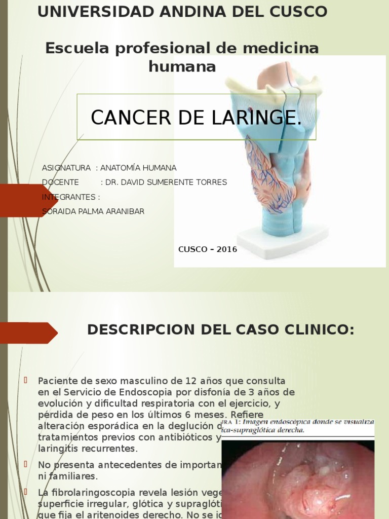 Cancer de Laringe | Cáncer | Especialidades Medicas