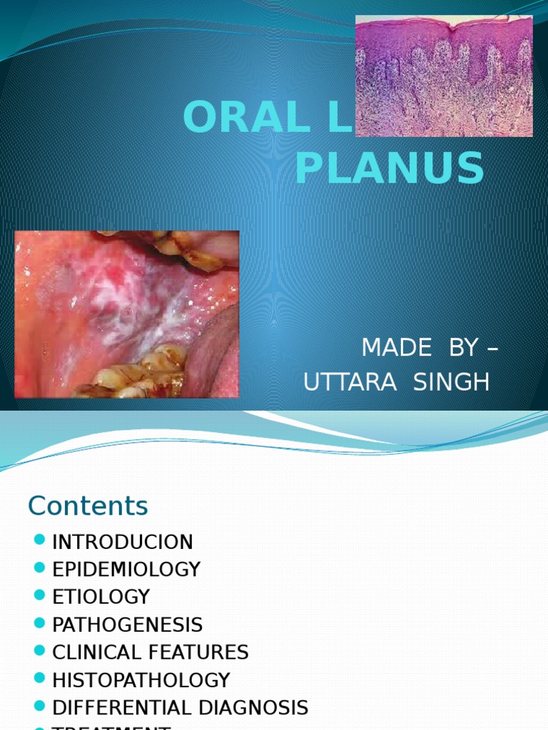 Oral Lichen Planus | PDF | Cutaneous Conditions | Medical Specialties