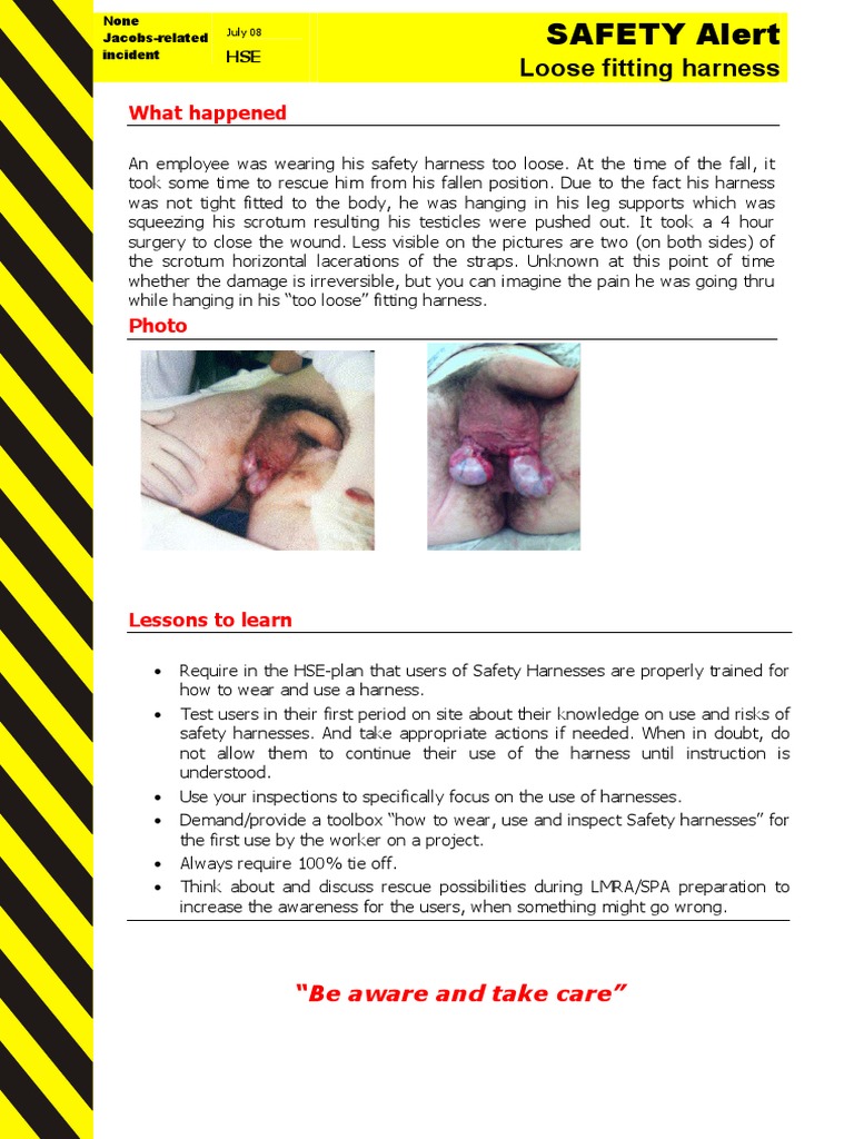 Loose Fitting Harness | PDF | Science & Mathematics