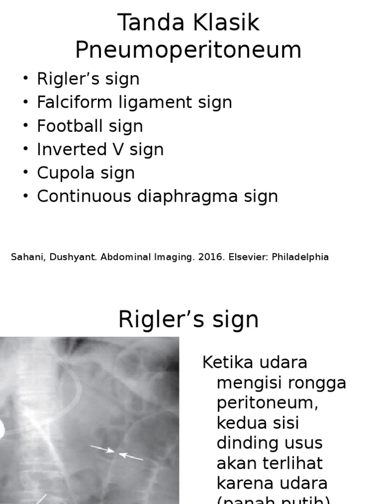 Tanda Klasik Pneumoperitoneum dalam Radiologi | PDF | Ilmu Sosial | Sejarah