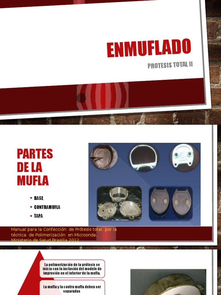Proceso de Enmuflado en Prótesis Total | PDF | Dentadura postiza ...