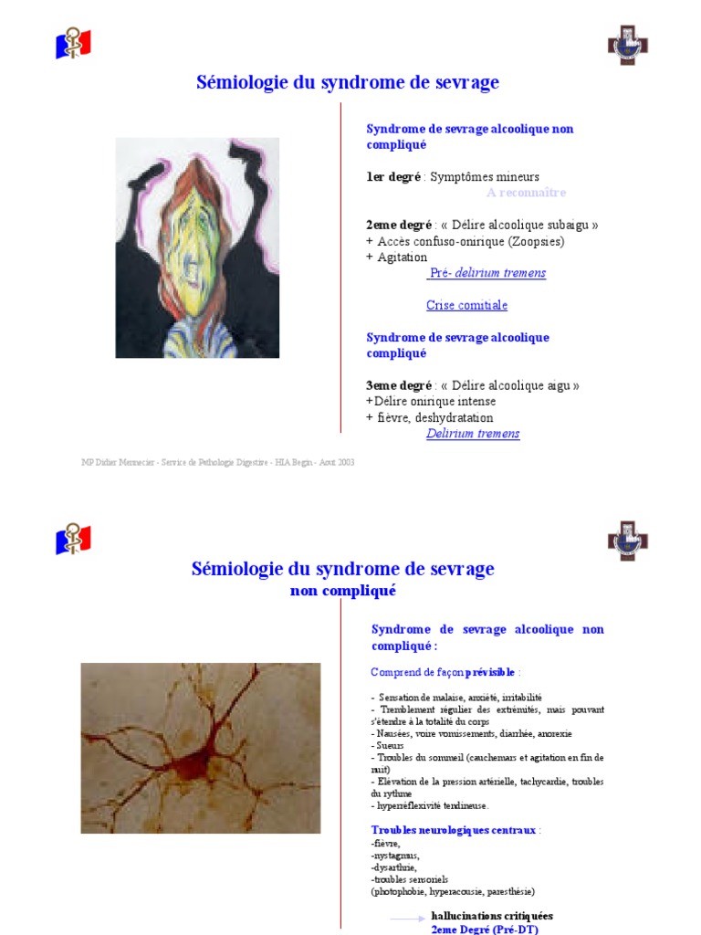 Syndrome de sevrage alcoolique et DT | PDF | Sevrage (toxicologie ...