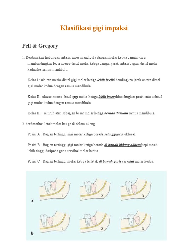 Klasifikasi Gigi Impaksi Molar Ketiga | PDF
