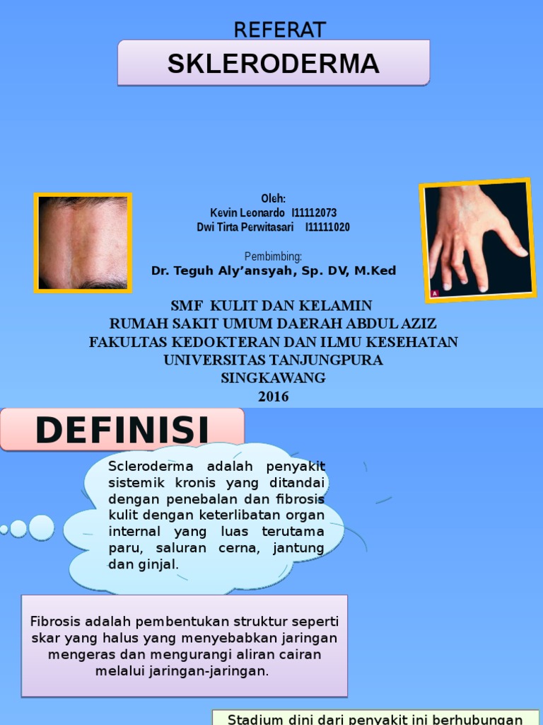 Skleroderma | PDF